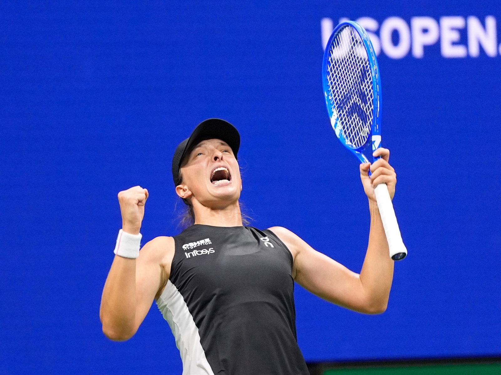 “I Started to Feel Worse and Worse”: Anna Kalinskaya Details Heat ...